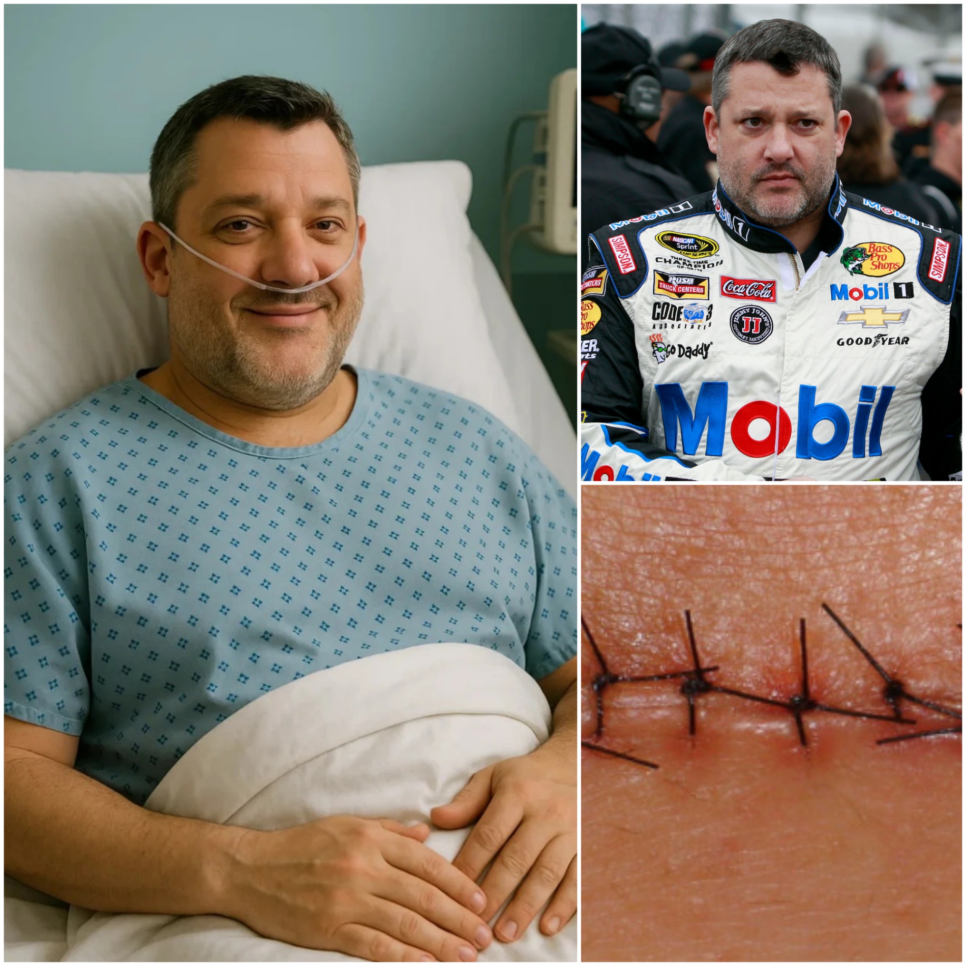 GOOD NEWS FROM TONY STEWART: NASCAR LEGEND SPEAKS OUT AFTER SURGERY ...